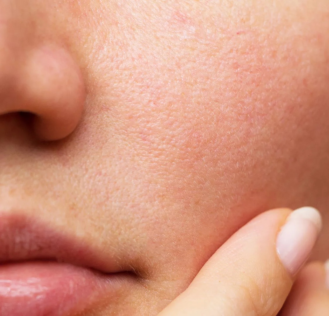 Skin Type Quiz - Iehana Cosmetics